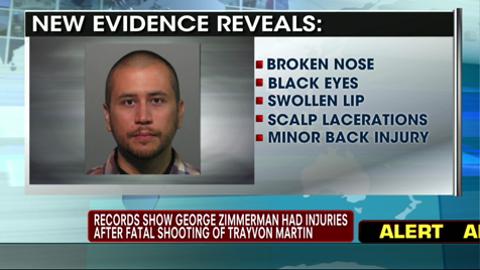 Could New Medical Evidence Support George Zimmerman's Claims in Trayvon ...