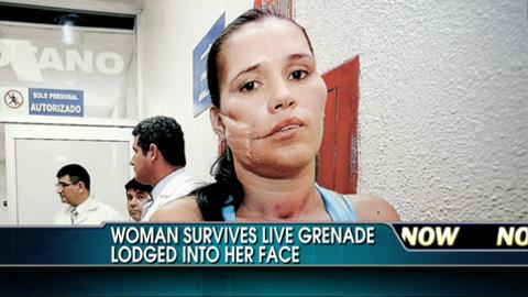 Amazing Story: Mexican Woman Karla Flores Survives After Live Grenade ...